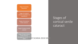 CATARACT (lens) REVISION NOTES | PDF