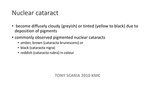 CATARACT (lens) REVISION NOTES | PDF