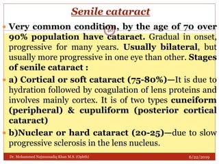 Lens & Cataract | PPTX