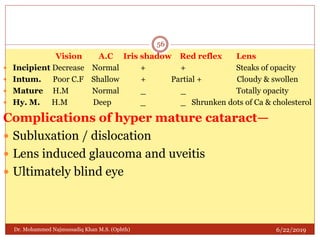 Lens & Cataract | PPTX