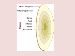 Lens ( Ophthalmology- Quick Revision ) | PPT