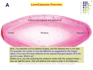 Lens-cataract overview overview and int.pptx