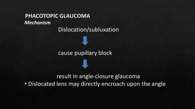 Lens induced glaucoma - DR ARNAV | PPTX