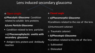 Phacolytic Glaucoma