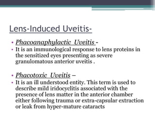 Lens Induced Uveitis | PPTX