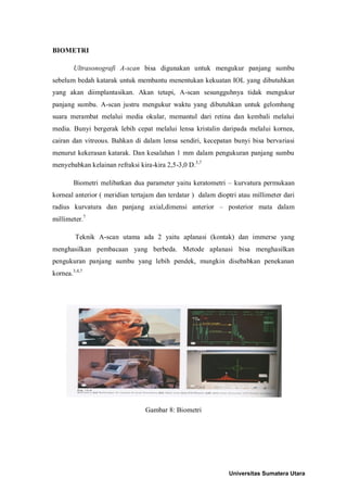 LENSA INTRA OKULER 2.pdf