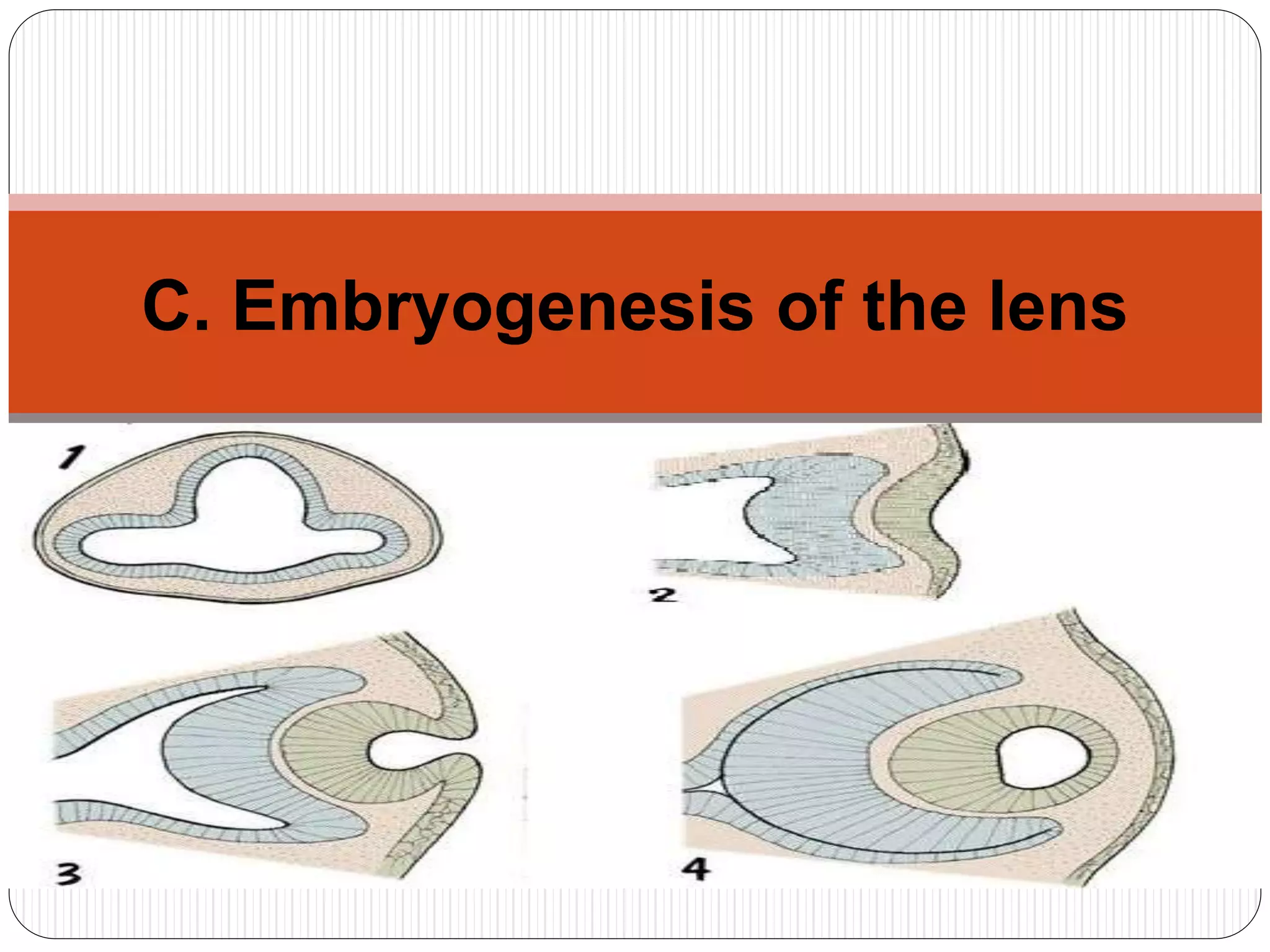 Lens and cataract | PPTX