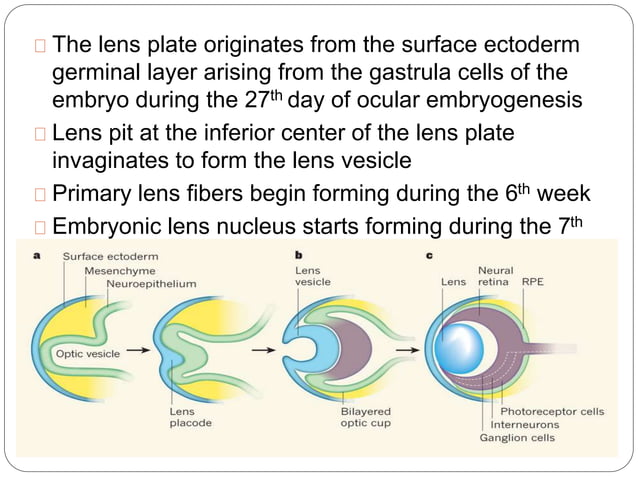 Lens and cataract | PPTX | Eye and Vision Conditions | Diseases and ...