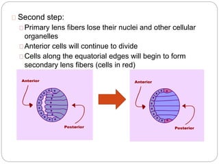 Lens and cataract | PPTX