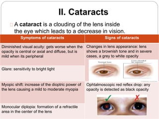 Lens and cataract | PPTX