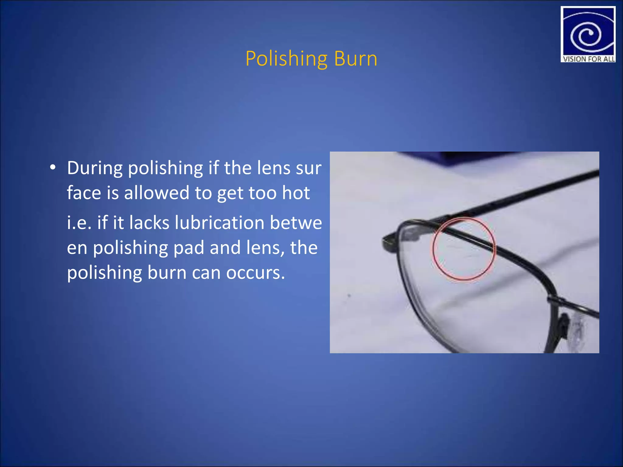 Lens defects or lens fault ppt | PPTX