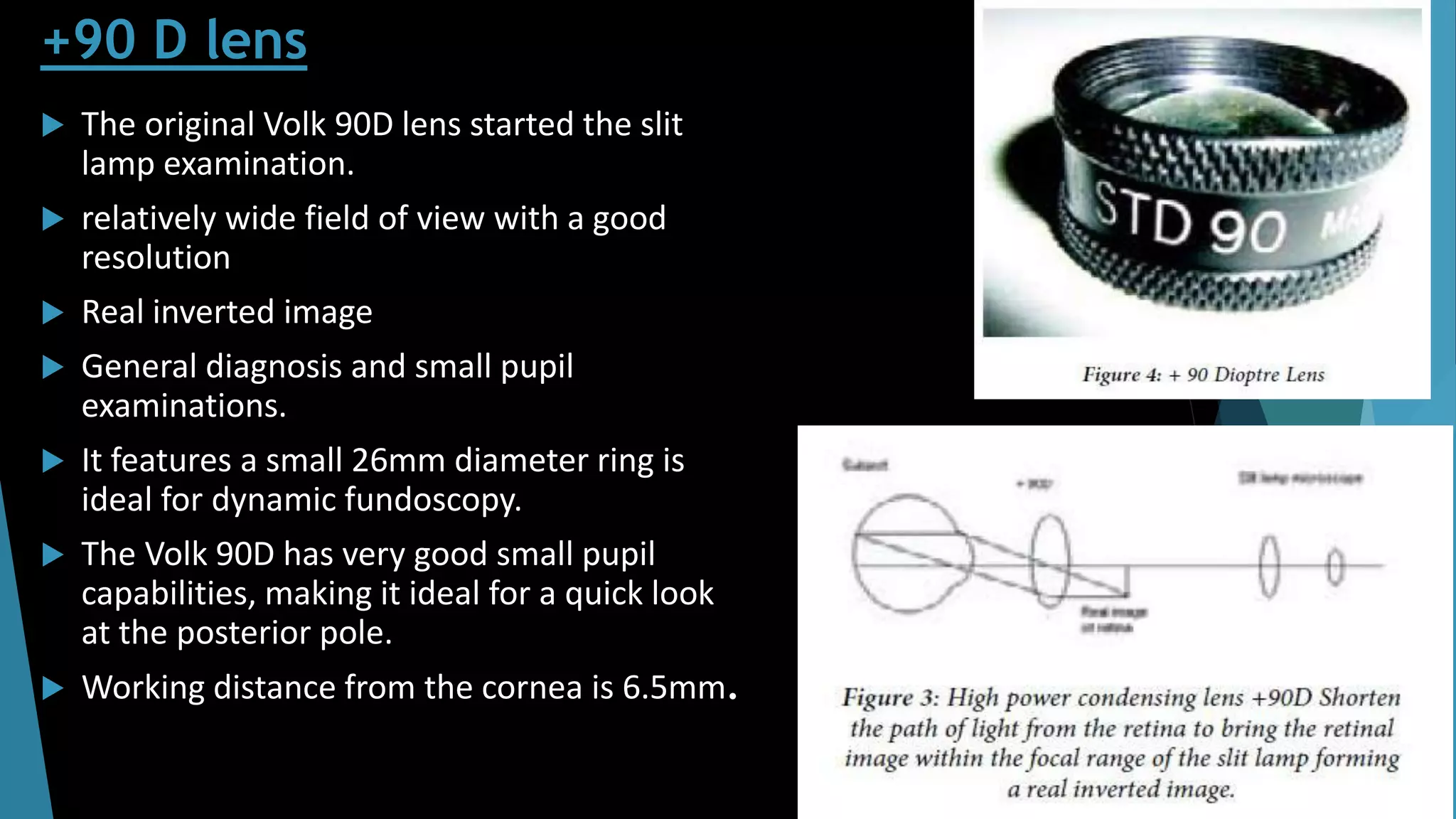 Lenses in ophthalmology | PPTX