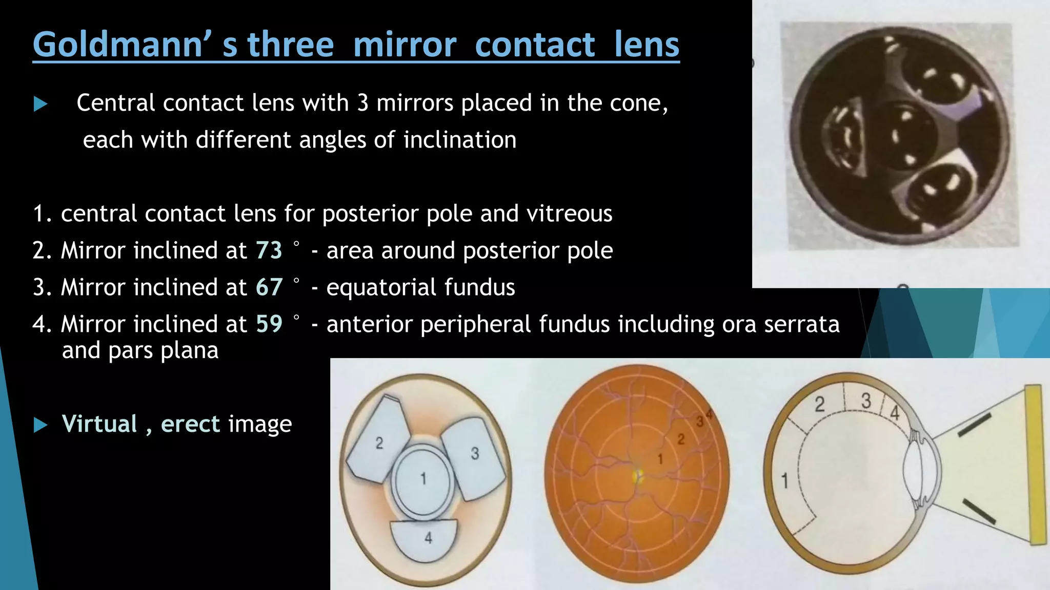Lenses in ophthalmology | PPTX