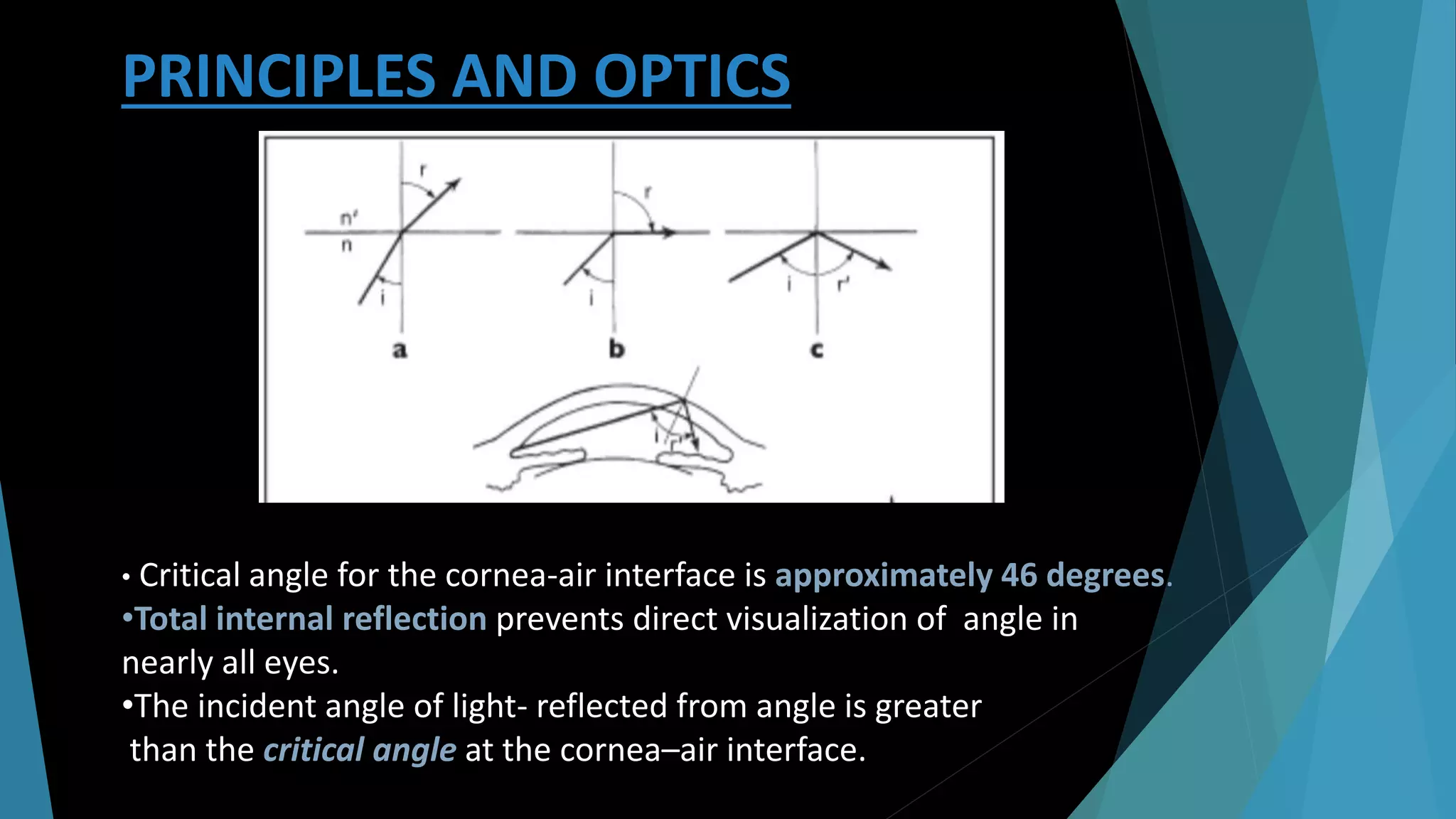 Lenses in ophthalmology | PPTX