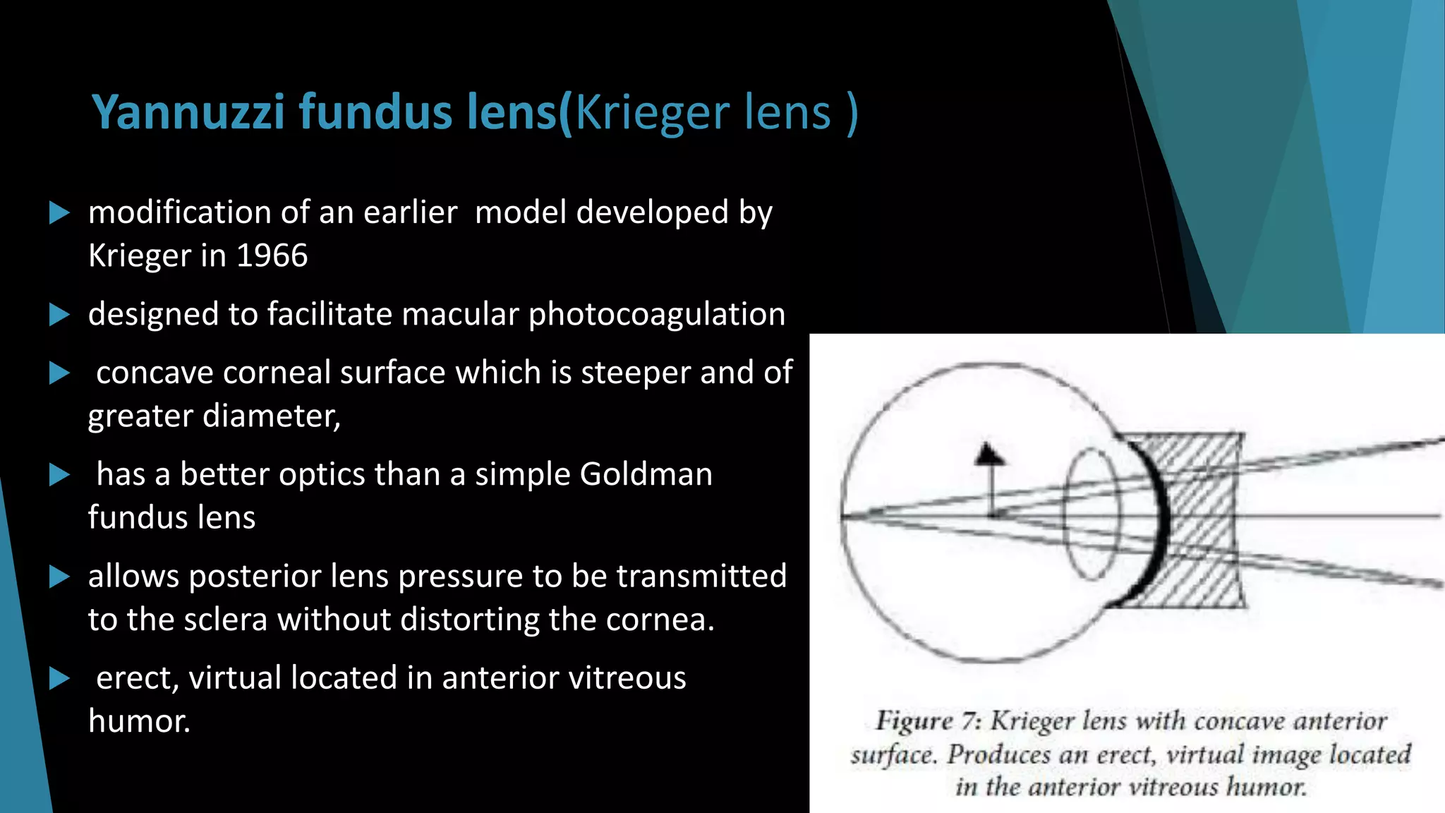 Lenses in ophthalmology | PPTX
