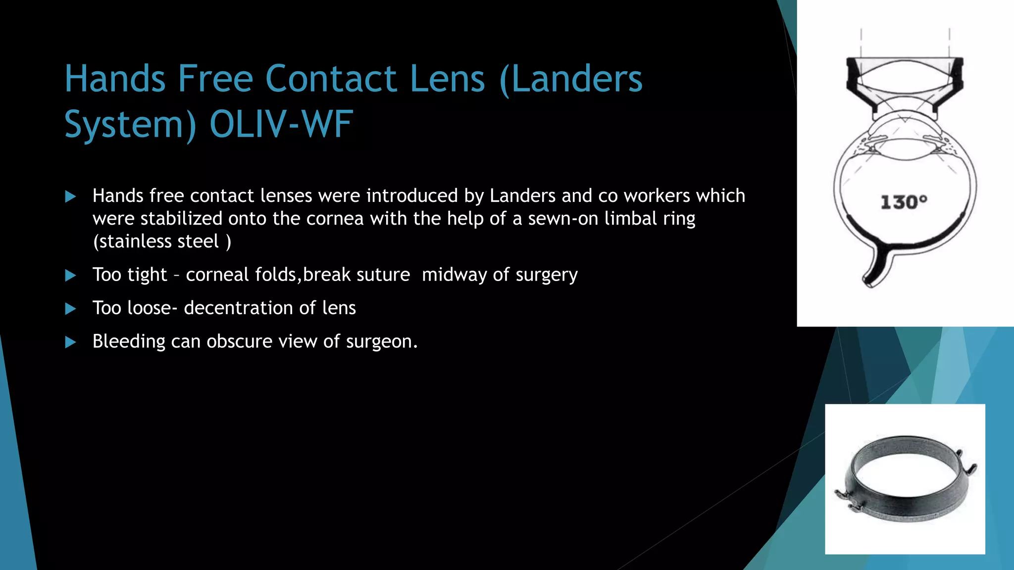 Lenses in ophthalmology | PPTX