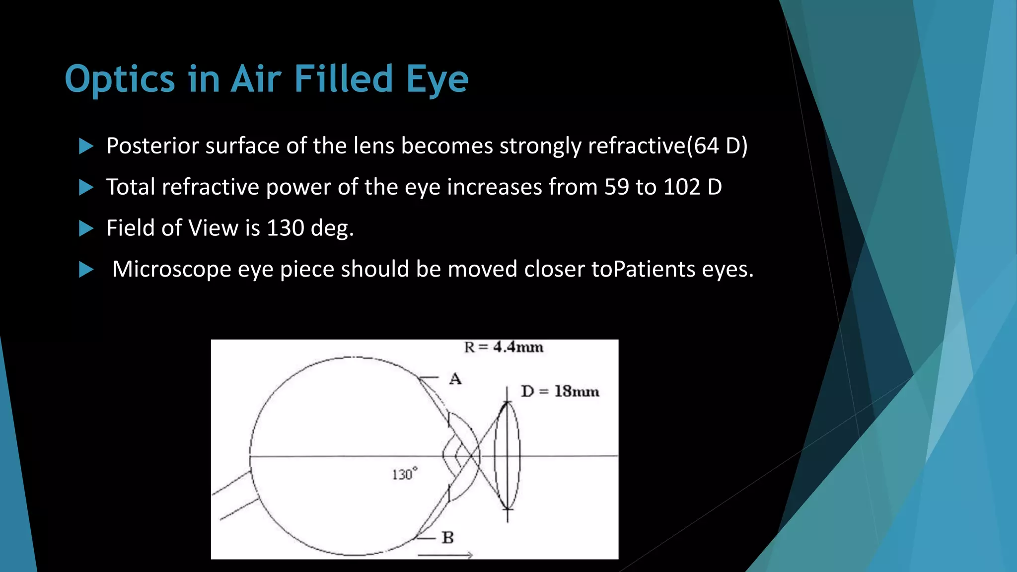 Lenses in ophthalmology | PPTX