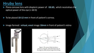 Lenses in ophthalmology | PPTX