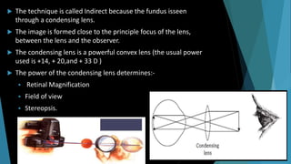 Lenses in ophthalmology | PPTX