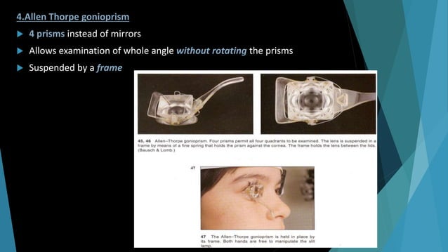 Lenses in ophthalmology | PPTX | 3-D Graphics | Computer Software and ...