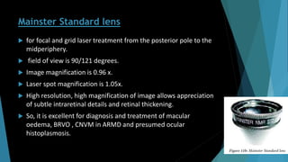 Lenses in ophthalmology | PPTX