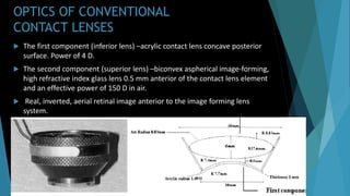 Lenses in ophthalmology | PPTX