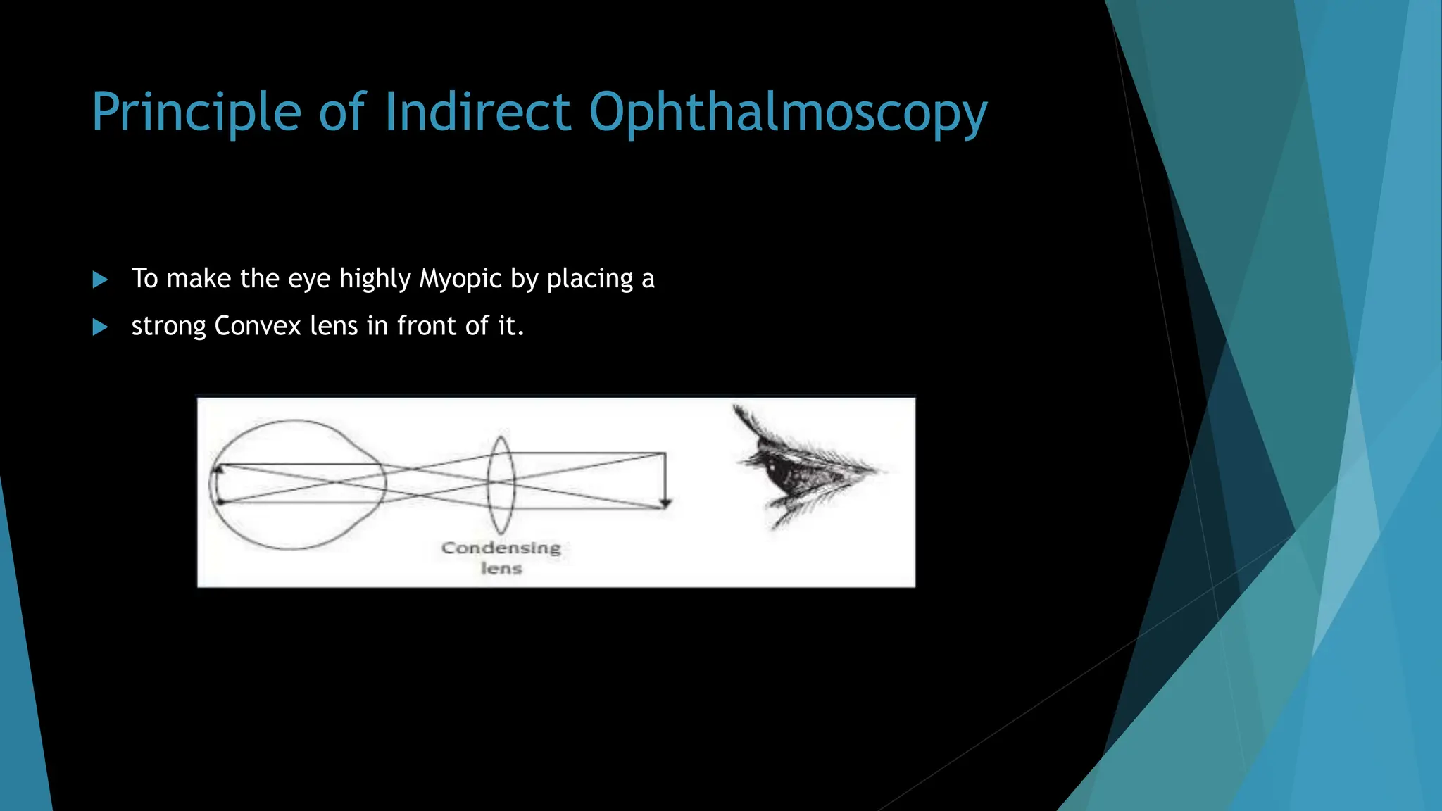 lensesinophthalmology-171212163049 (1).pdf
