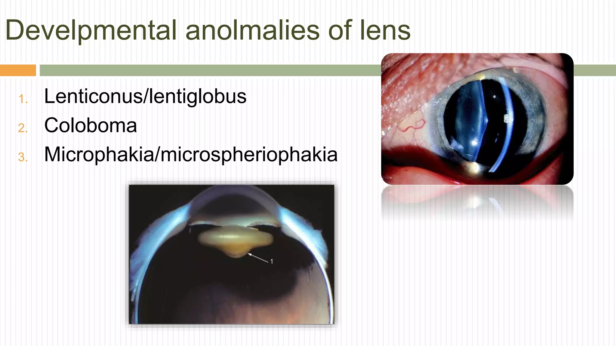 Anatomy and physiology of lens | PPTX