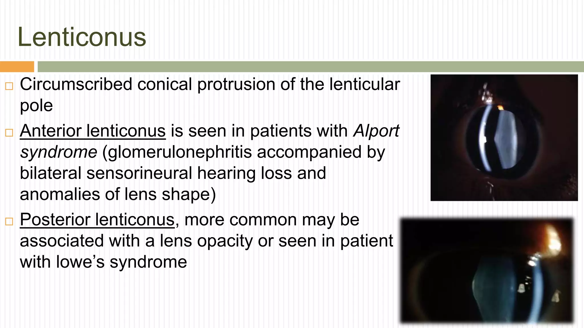 Anatomy and physiology of lens | PPTX