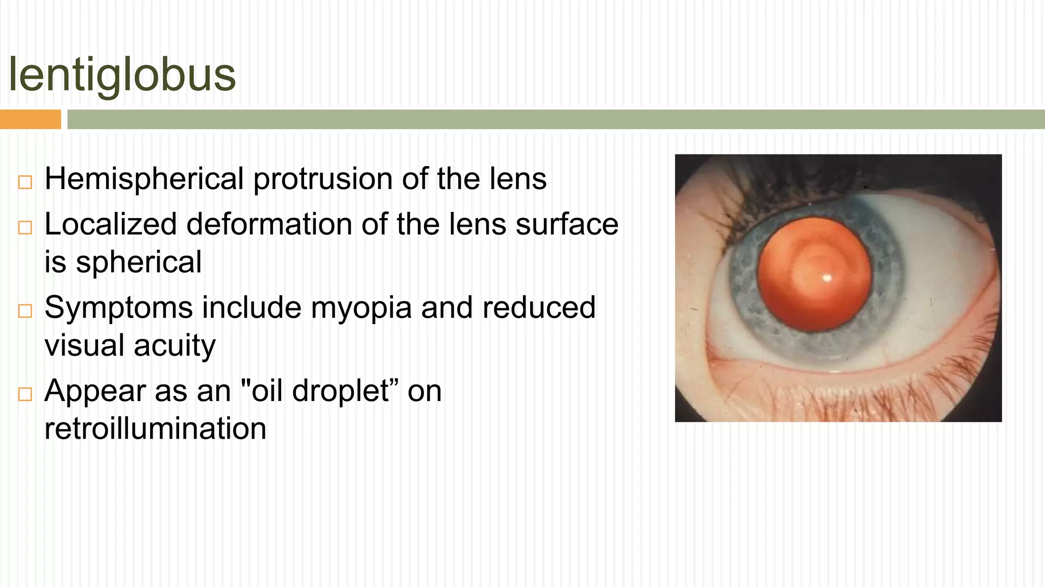 Anatomy and physiology of lens | PPTX