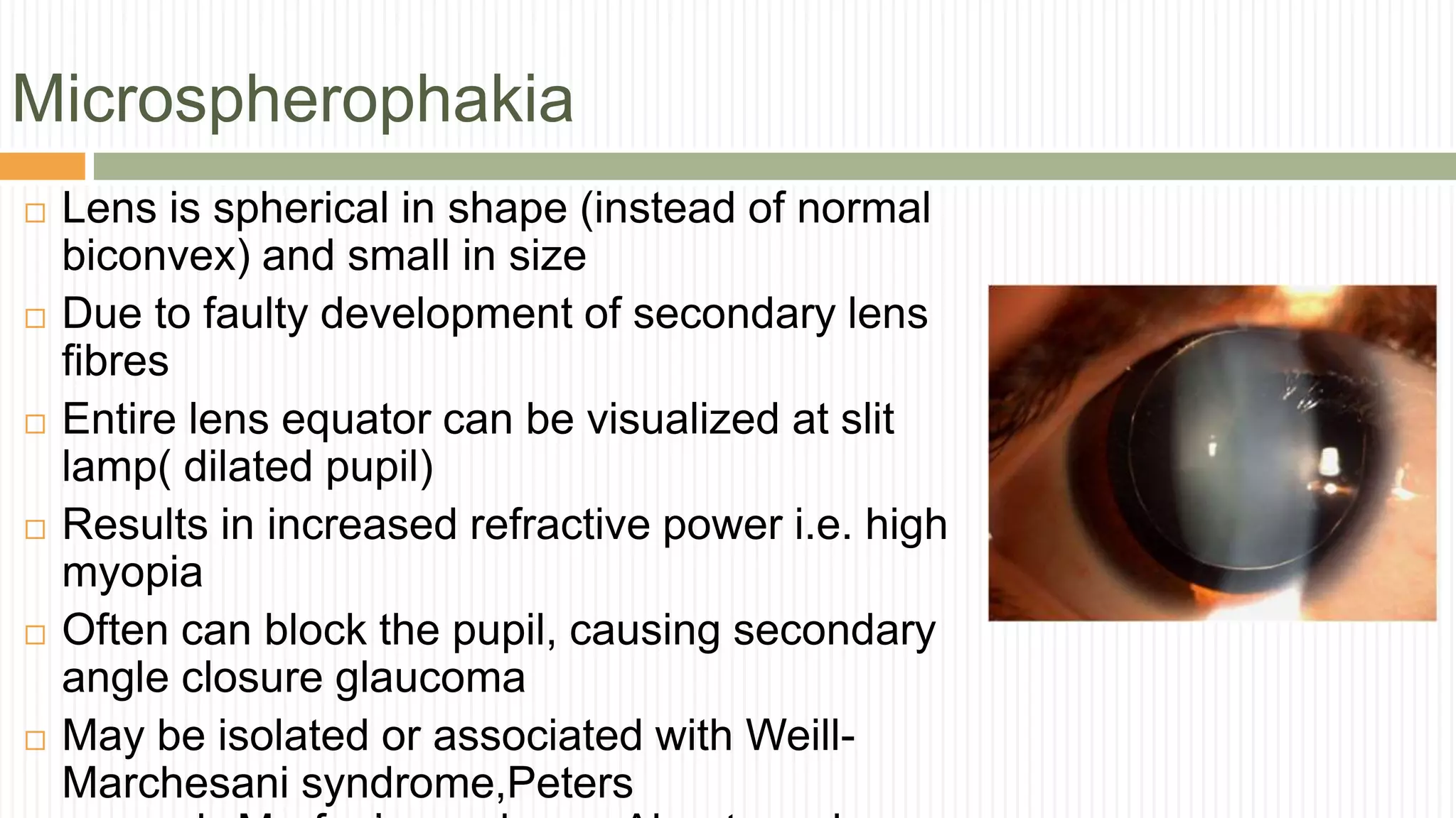 Anatomy and physiology of lens | PPTX