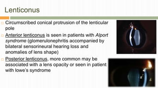 Anatomy and physiology of lens | PPTX