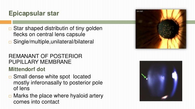 Anatomy and physiology of lens