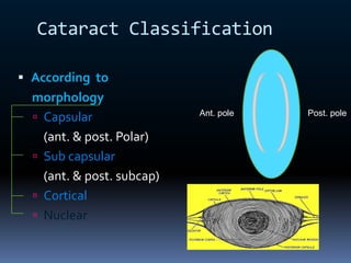 Lens for undergraduate final 11 2017 part 1 a - gif image for slide ...