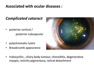 Lens i 06.04.17,dr.n.swathi | PPTX