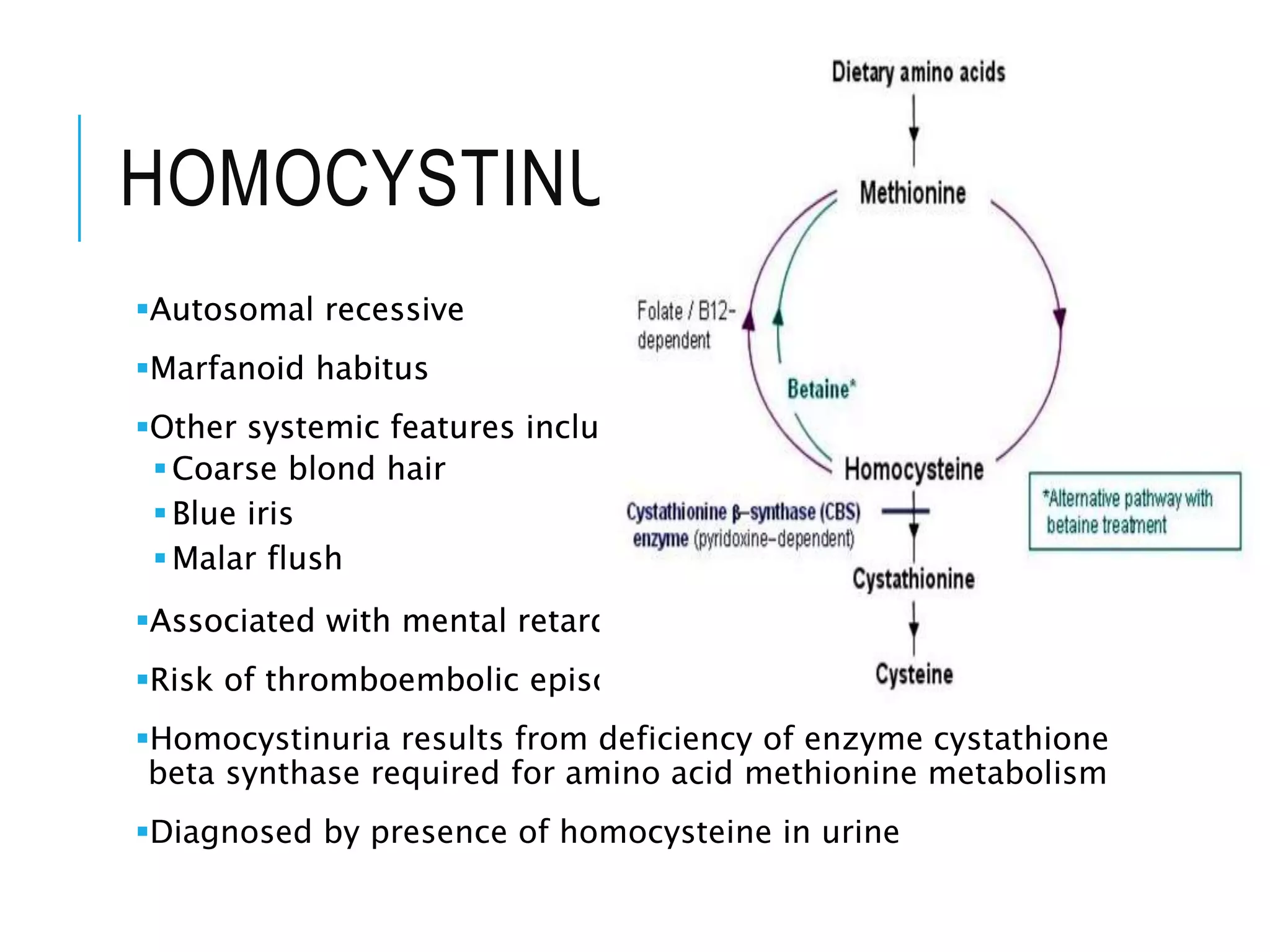 Lens induced glaucoma | PPTX
