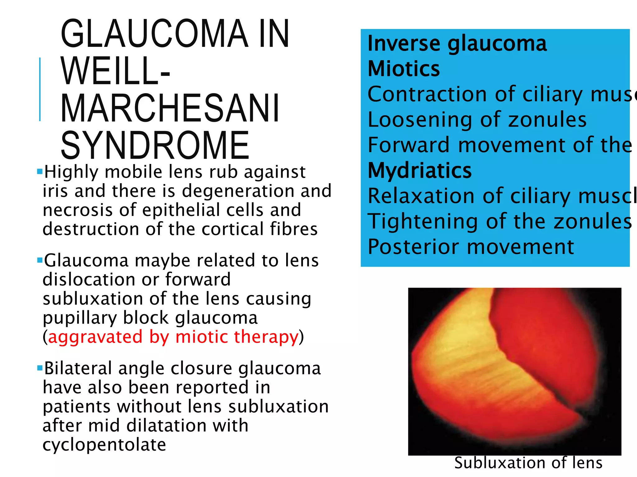 Lens induced glaucoma | PPTX