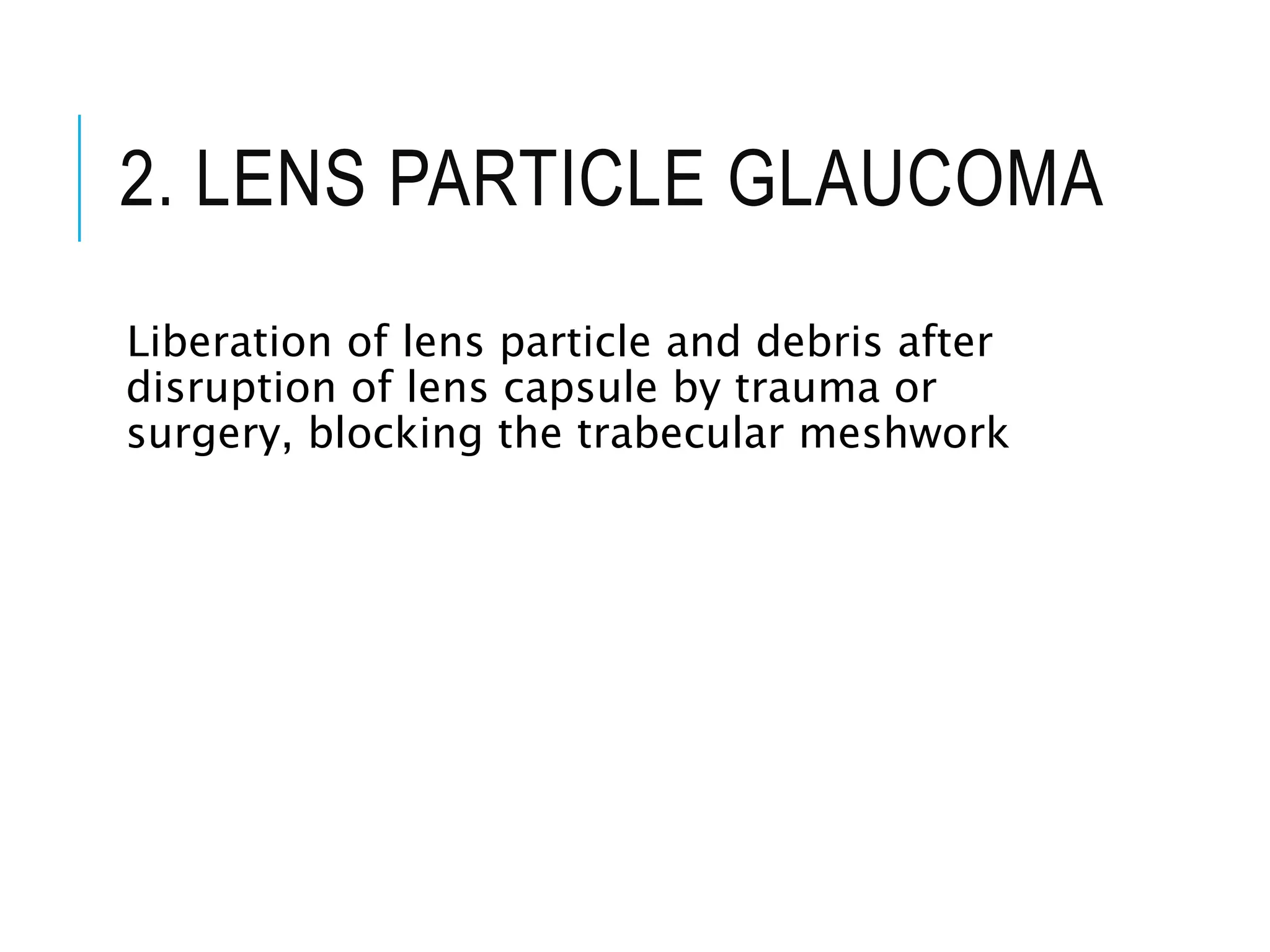Lens induced glaucoma | PPTX