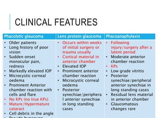 Lens induced glaucoma | PPTX