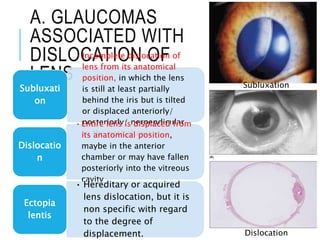 Phacolytic Glaucoma