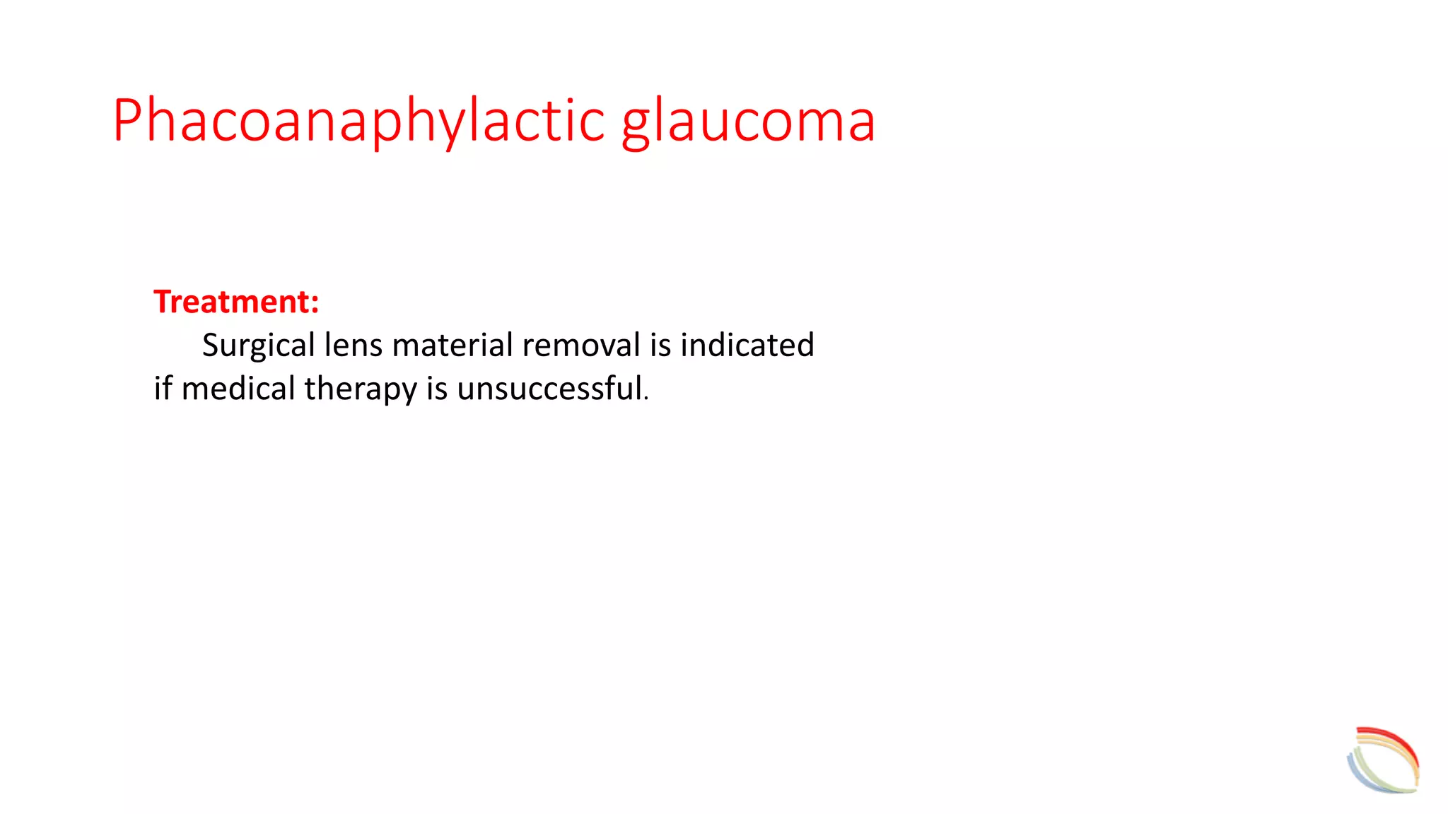 Lens induced glaucoma. | PPTX