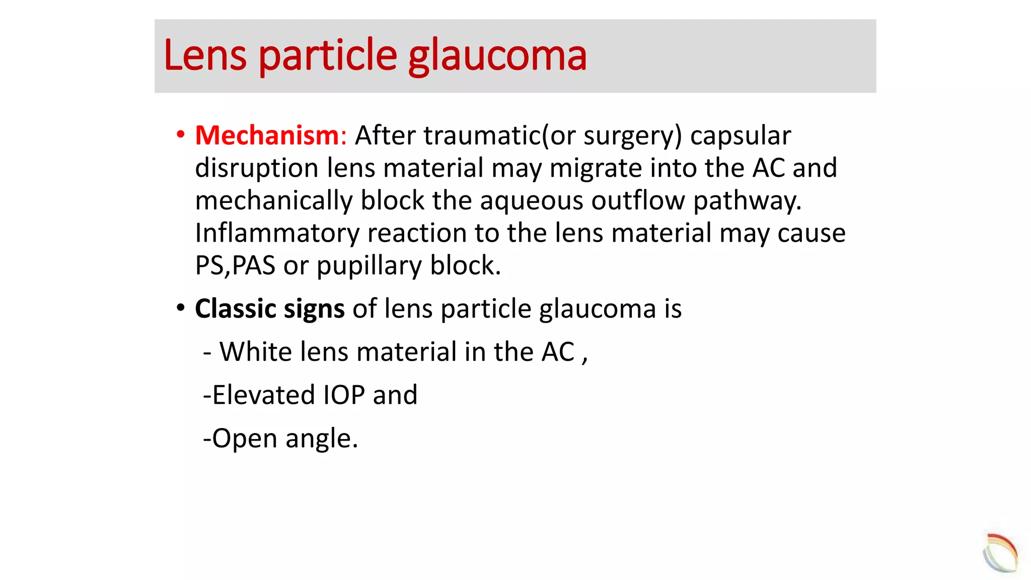 Lens induced glaucoma. | PPTX