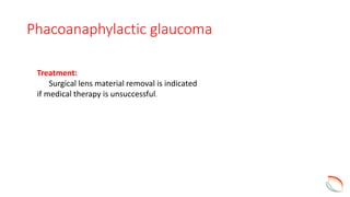 Lens induced glaucoma. | PPTX