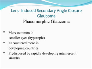 Lens Induced glaucoma caused by lens pathology | PPT