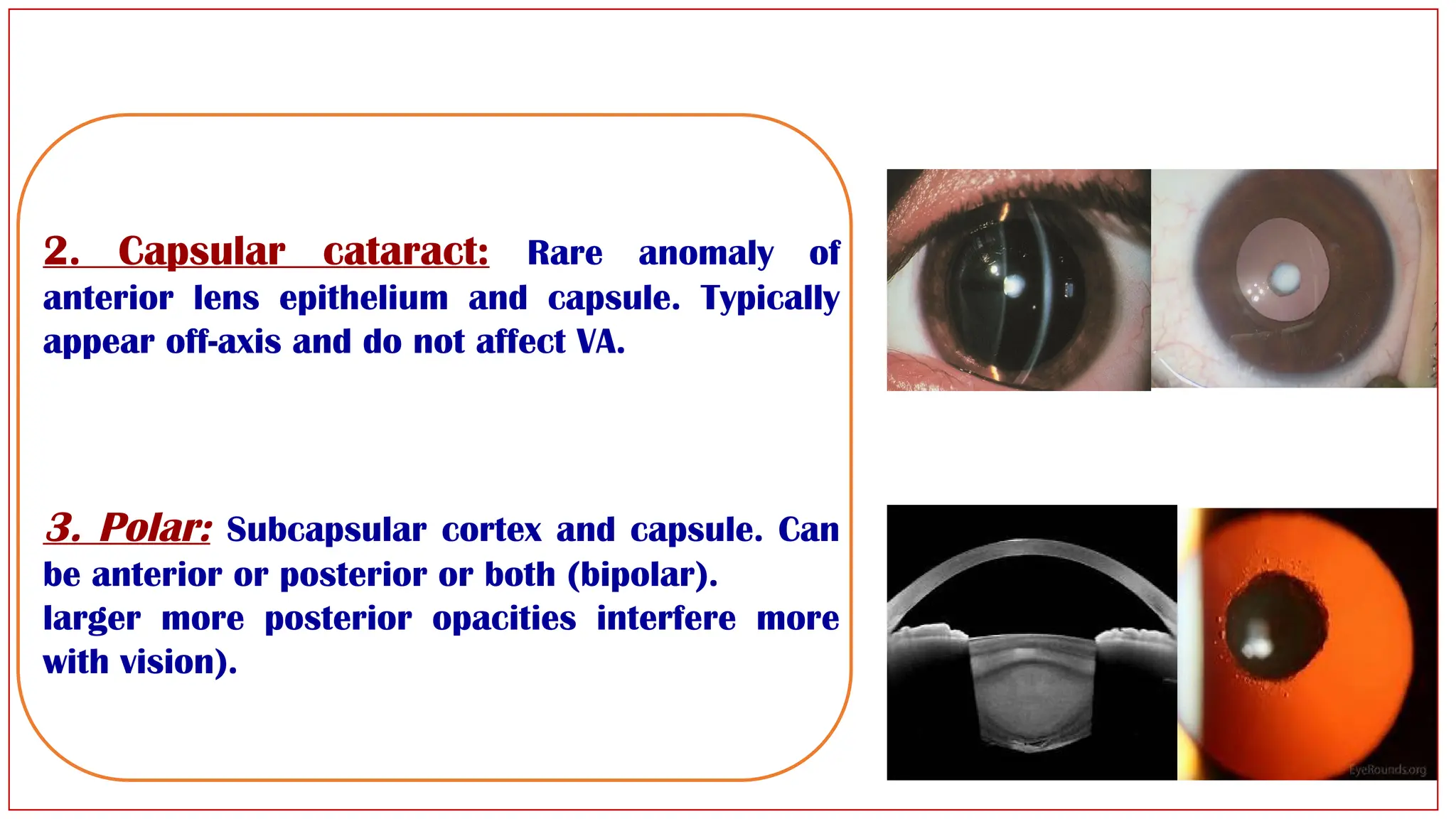 Lens lecture revision Arab Board HUCOM.pptx