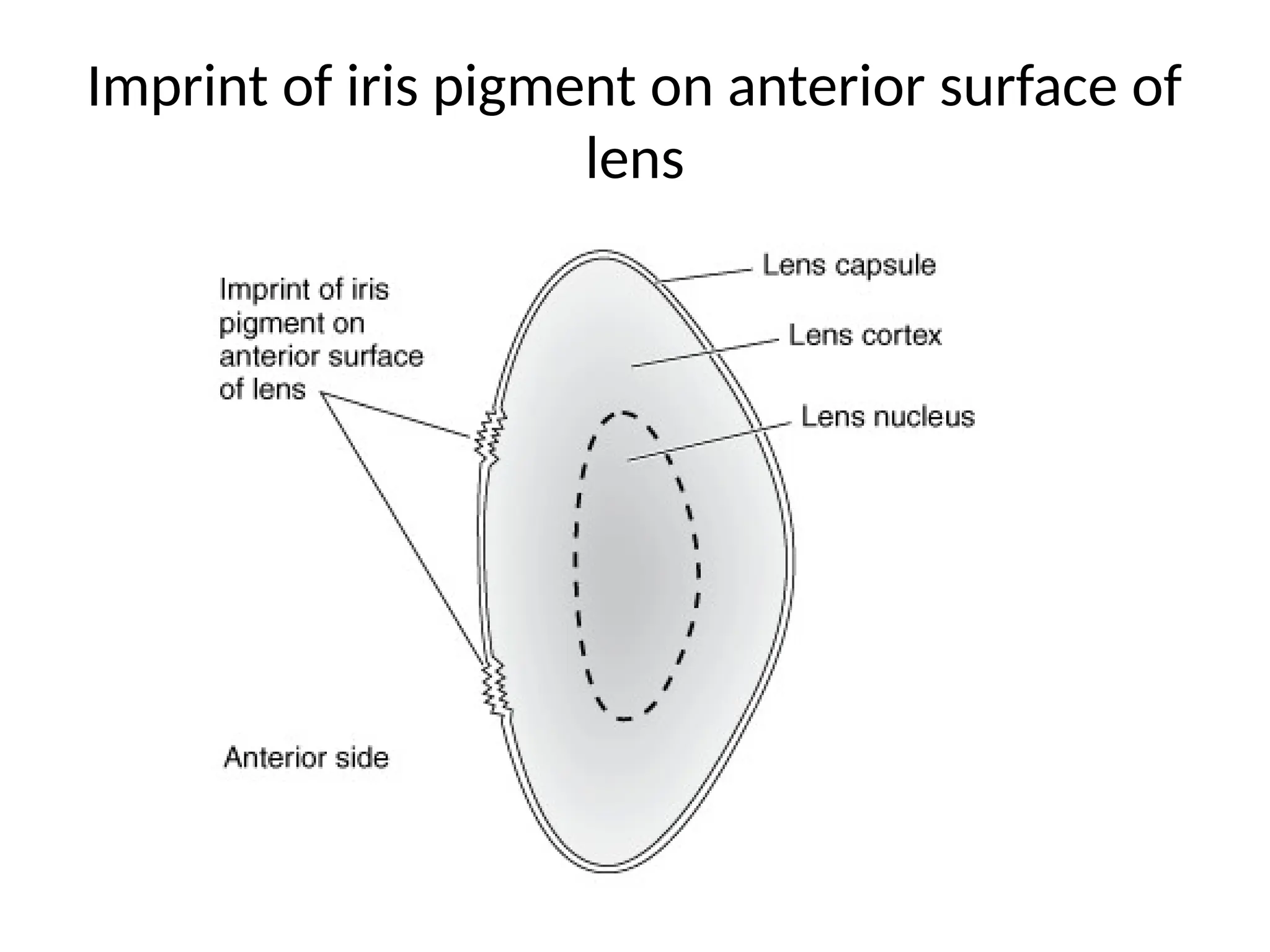 Lens & Lens Diseases.pptx VVBCvHbvzbHB Cc nJ | PPTX
