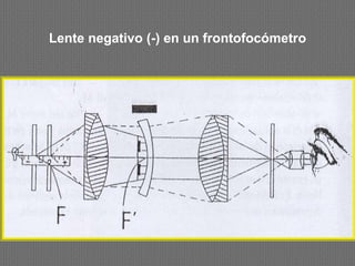 Lensometro | PPTX