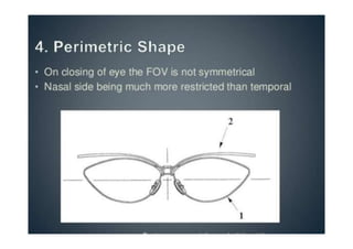 Lens shapes.pptx | Eye and Vision Conditions | Diseases and Conditions