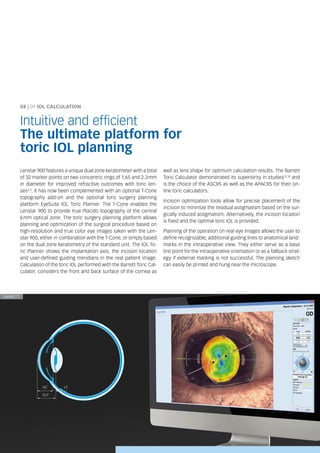Lenstar 900 'Improving Outcomes' Brochure | PDF