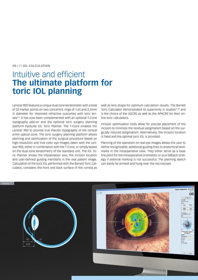 Lenstar 900 'Improving Outcomes' Brochure | PDF | Eye and Vision ...